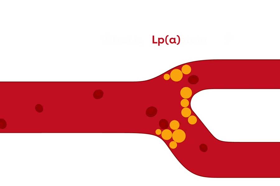 Lipoprotein (a) | Go Red for Women