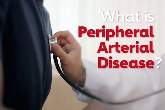 What is PAD? The facts on peripheral artery disease. | Go Red for Women