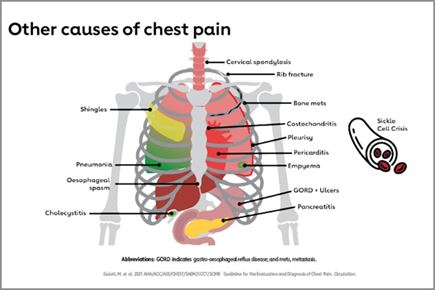 2021 Guideline for the Evaluation and Diagnosis of Chest Pain ...