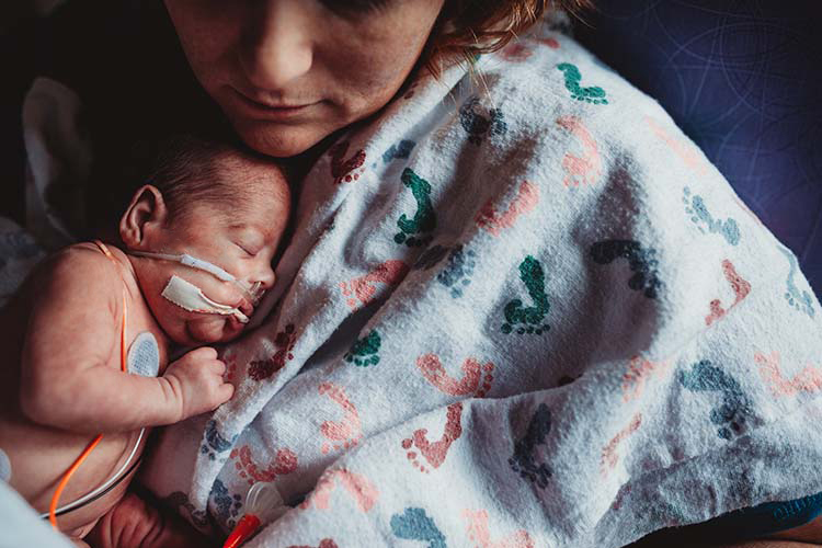 Developmental Care for Hospitalized Infants With Complex Congenital ...